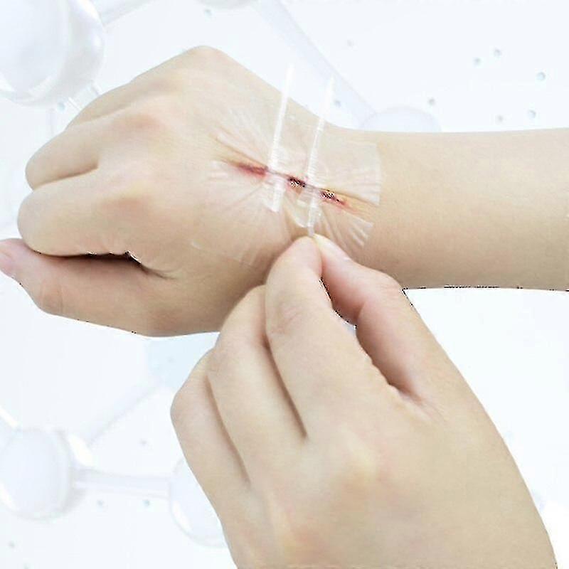 10pcs Zipper Tie Wound Closure Patch Hemostatic Patch Wound Fast Suture ...