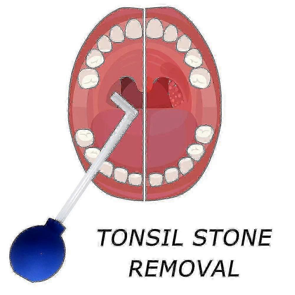 Tonsil Remover,tonsil Removal Tool Kit,tonsil Flosser,tonsilitis ...