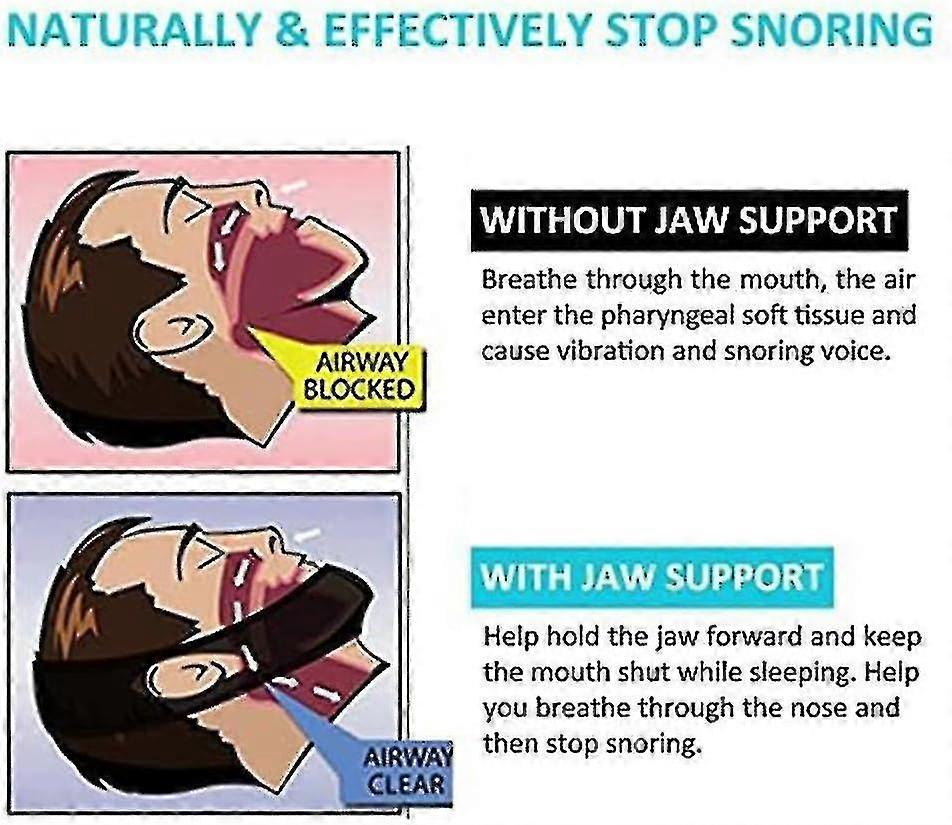Jaw Strap, 2024 New Oraclose Jaw Strap For Snoring, Effectively Reduce ...