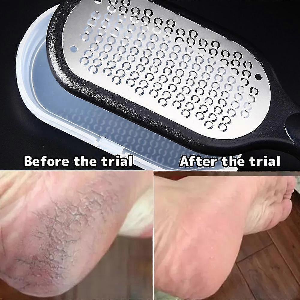 Foot Rubbing Board Dead Skin Callus Removal Foot File Scruper Foot ...