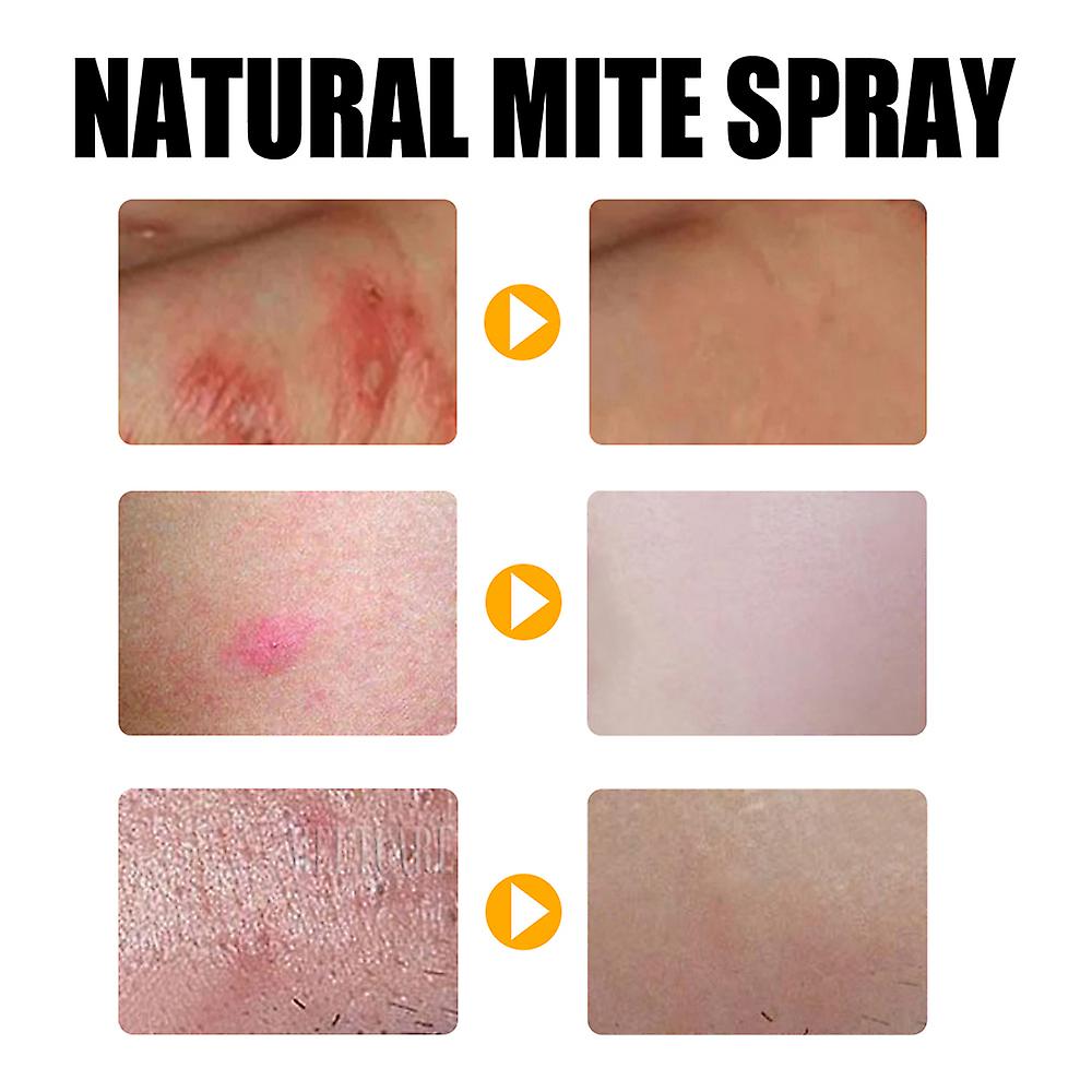 Bed Bug & Mite Killer Spray Gently Eliminate Dust Mites Human Safe ...