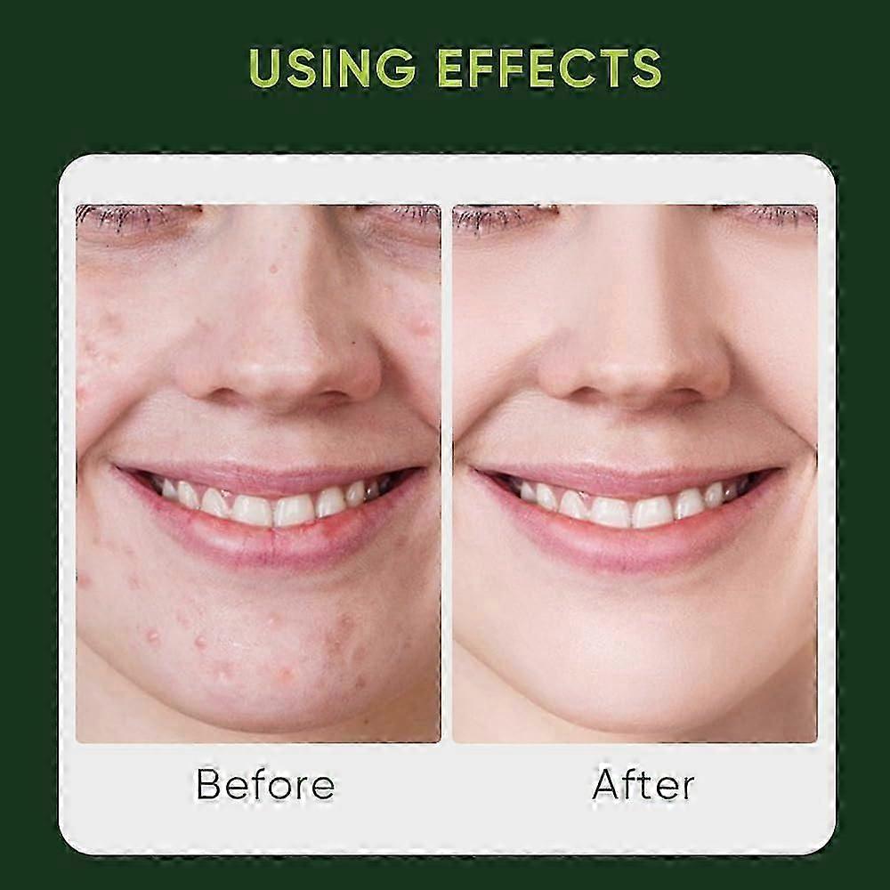 Licorice Essence,Licorice Root Essence,Hydrating, Moisturizing and Anti-Aging,Firming and ...