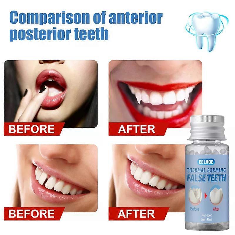 Temporary Teeth Repair Falseteeth Glue Resin Tooth Repair Glue Teeth ...