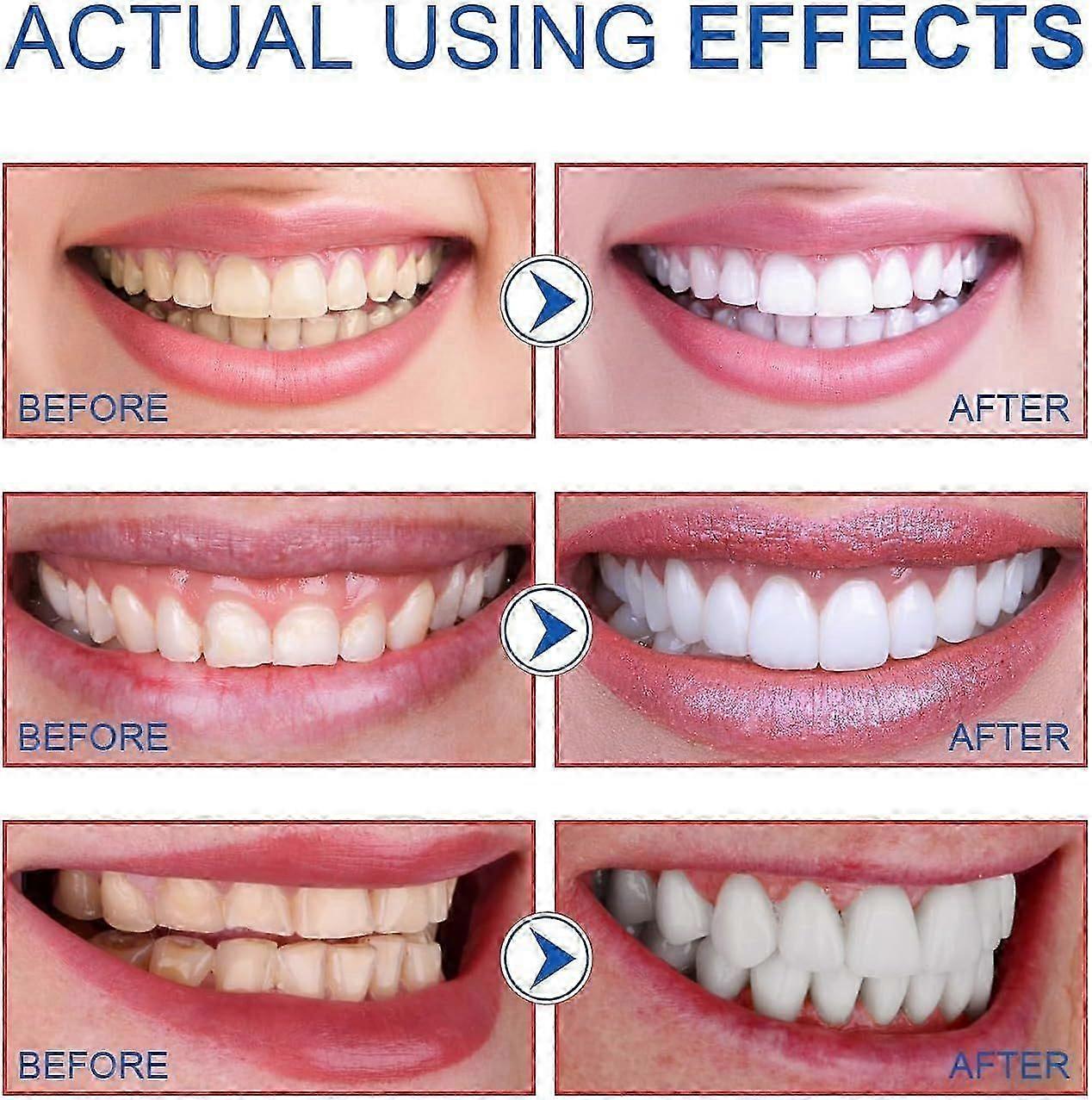 SP-6 Probiotic Whitening Toothpaste, Sp-6 Ultra Whitening Toothpaste ...