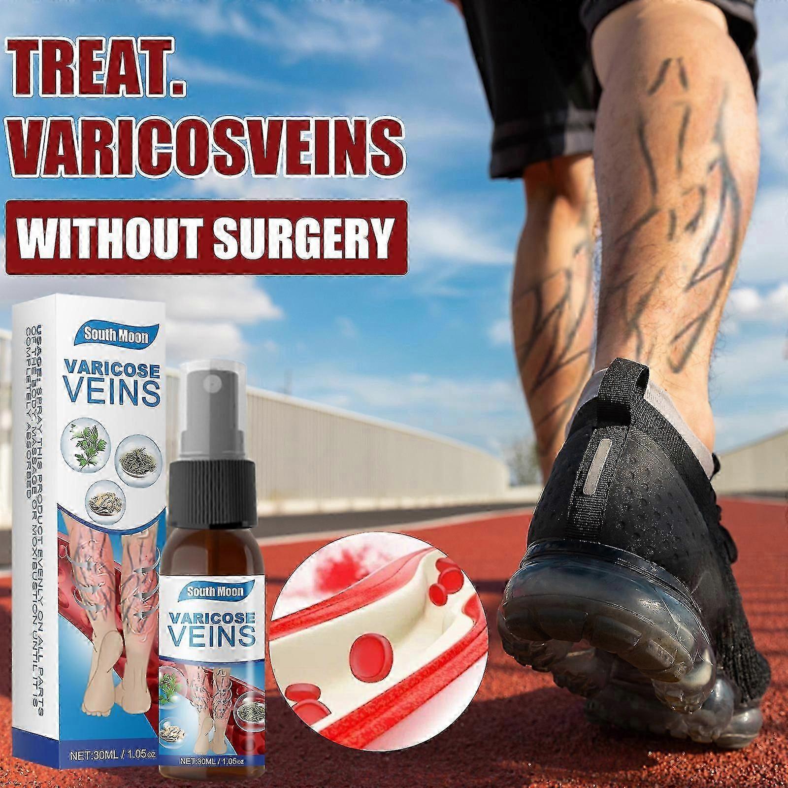 Varicose Vein Massage Spray 30ml Smoothing Vascular Bumps Smoothing ...