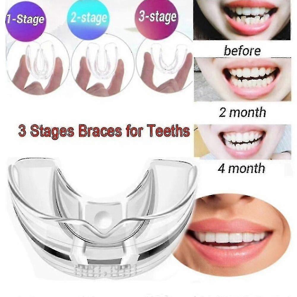 3pcs Dental Braces Orthodontic Teeth Trainer Set For Adults Orthotics ...