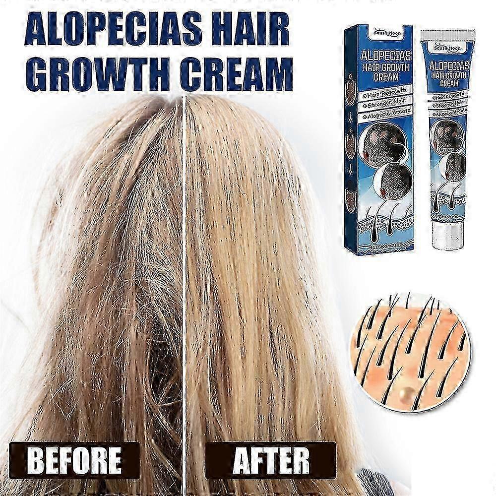 1-3x nya alopeci behandling kräm hår växer förhindra alopeci skallighet ...