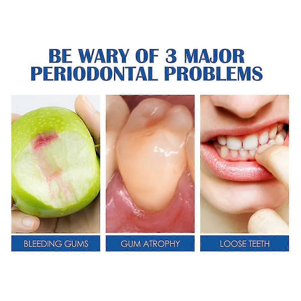 Mint Toothpaste Clean Gingival Tooth Fixation Toothpaste Curing Teeth ...