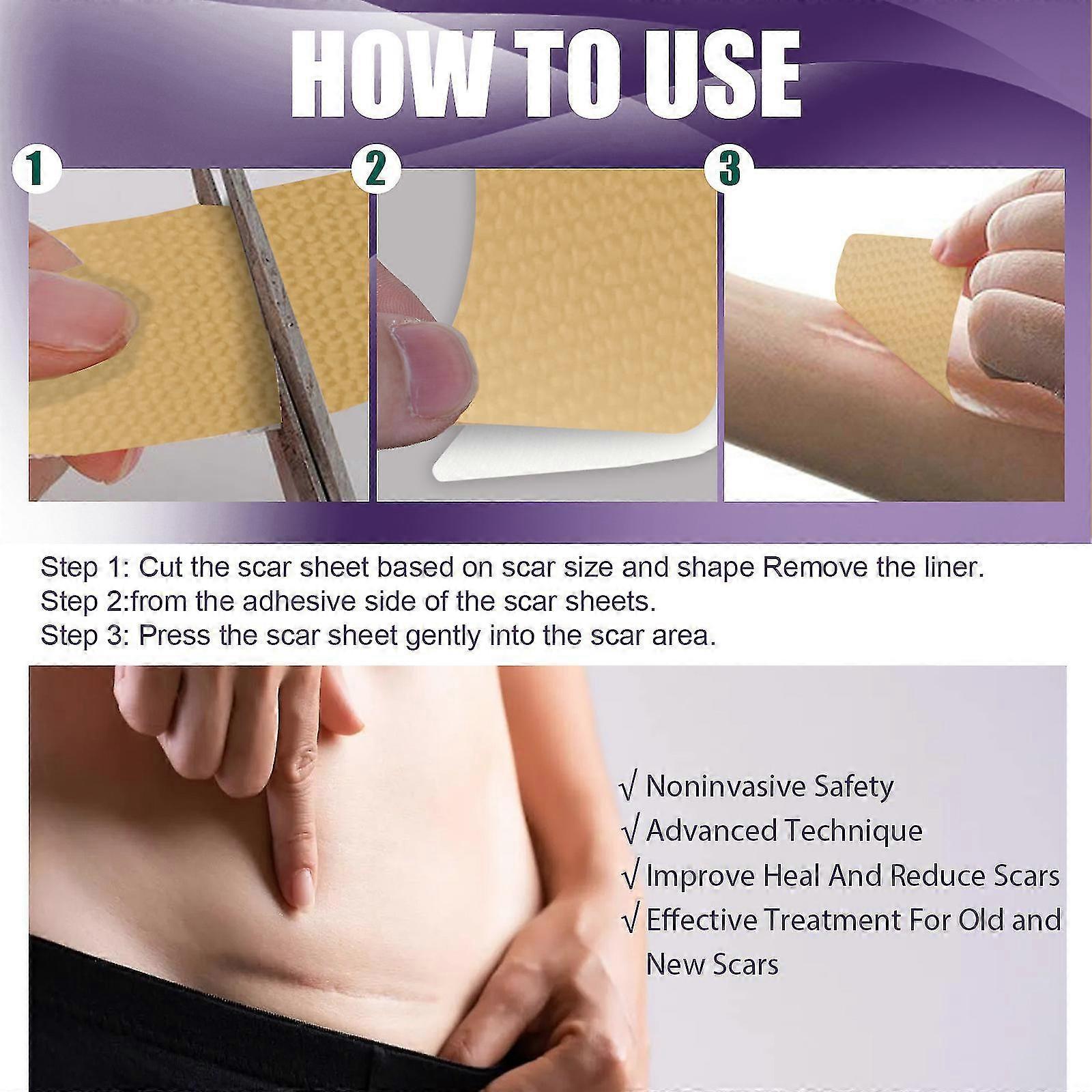 Silicone scar patch, effective scar removal, invisible silicone scar ...