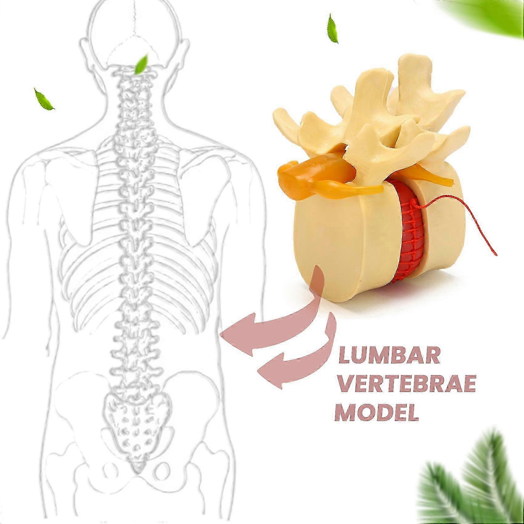 Lumbar Vertebrae Model Anatomical Spine Lumbar Disc Herniation Anatomy ...