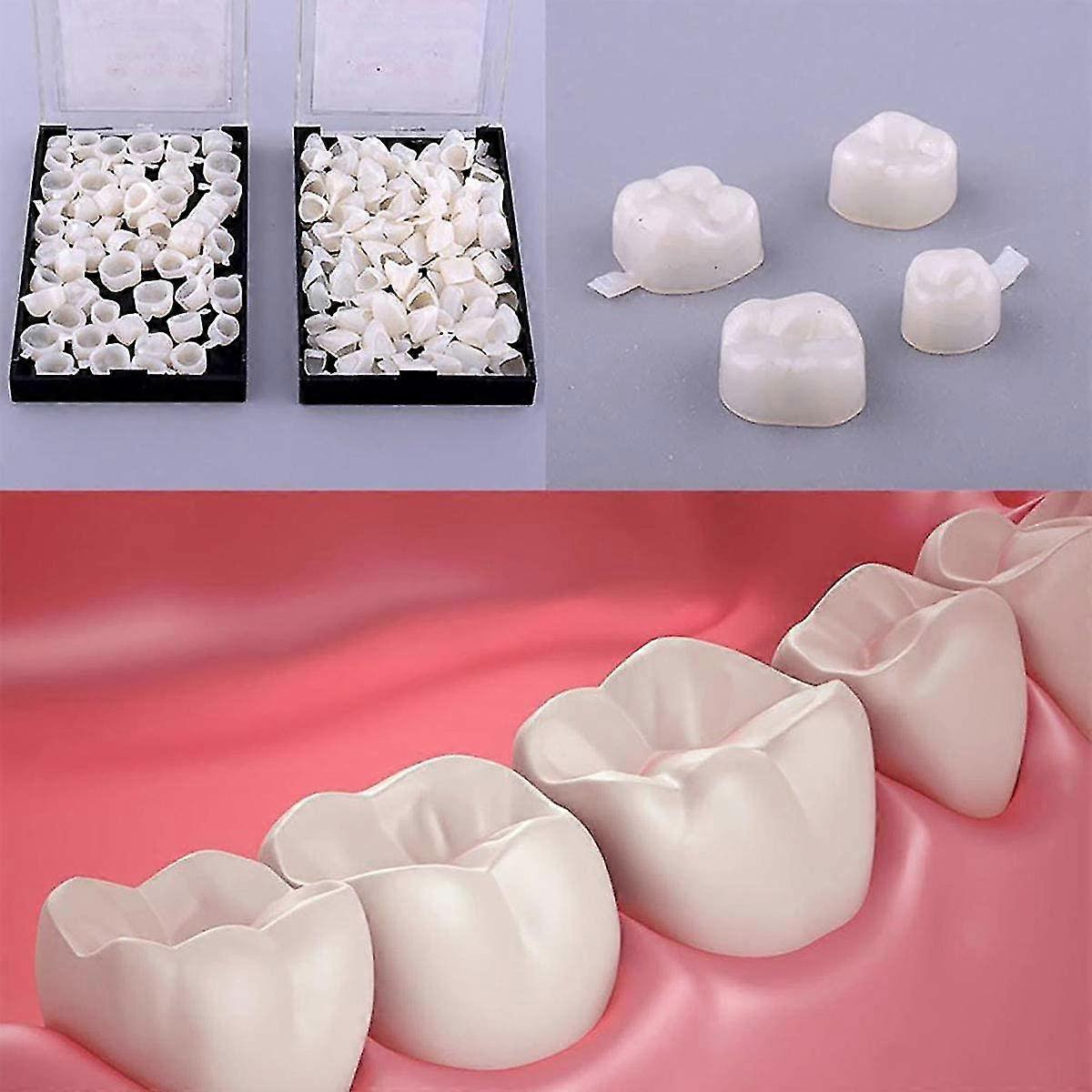 Dental Temporary Crown Veneer Material Children's Front Teeth Before ...