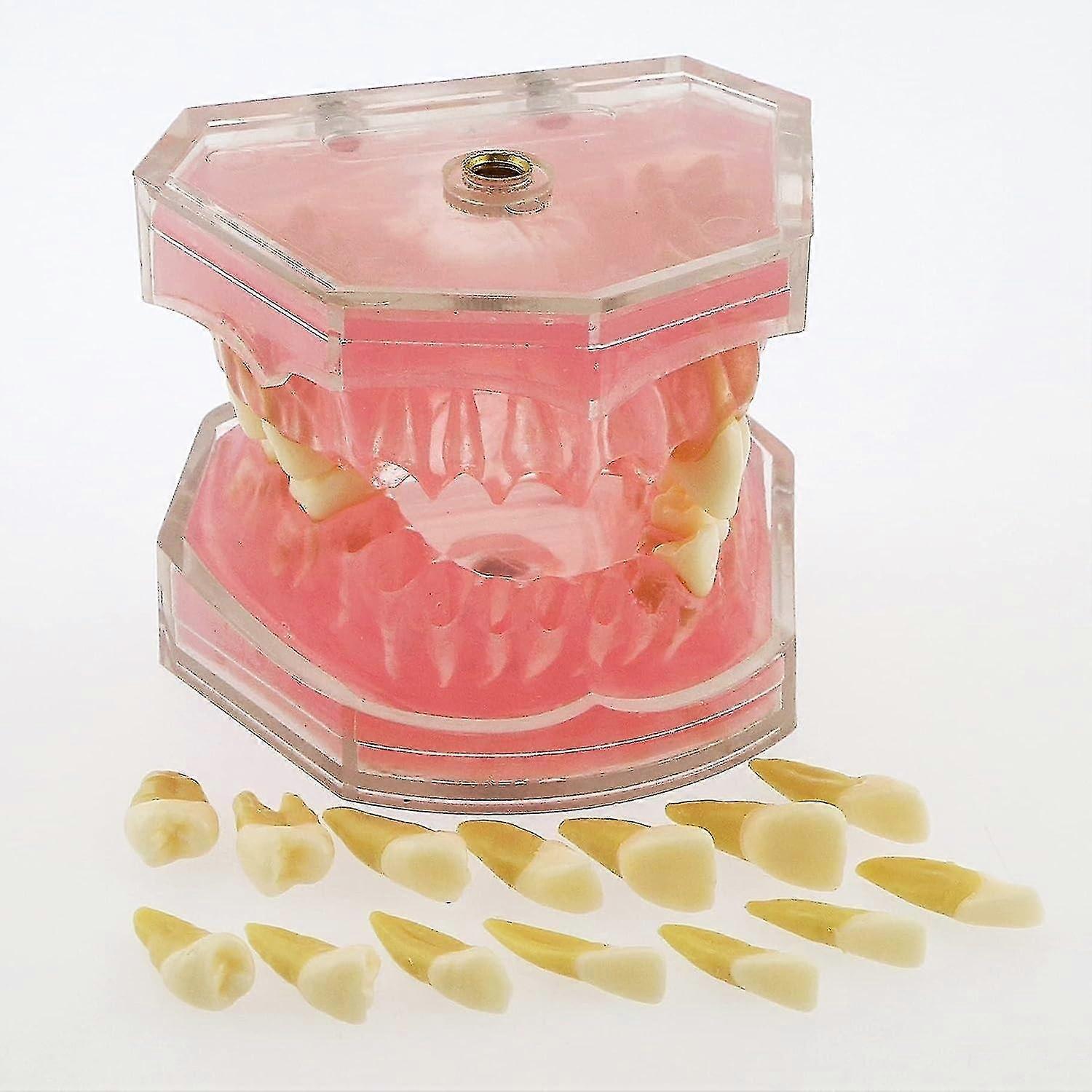 Dental Demonstration Tooth Model - Standard research teaching dental ...