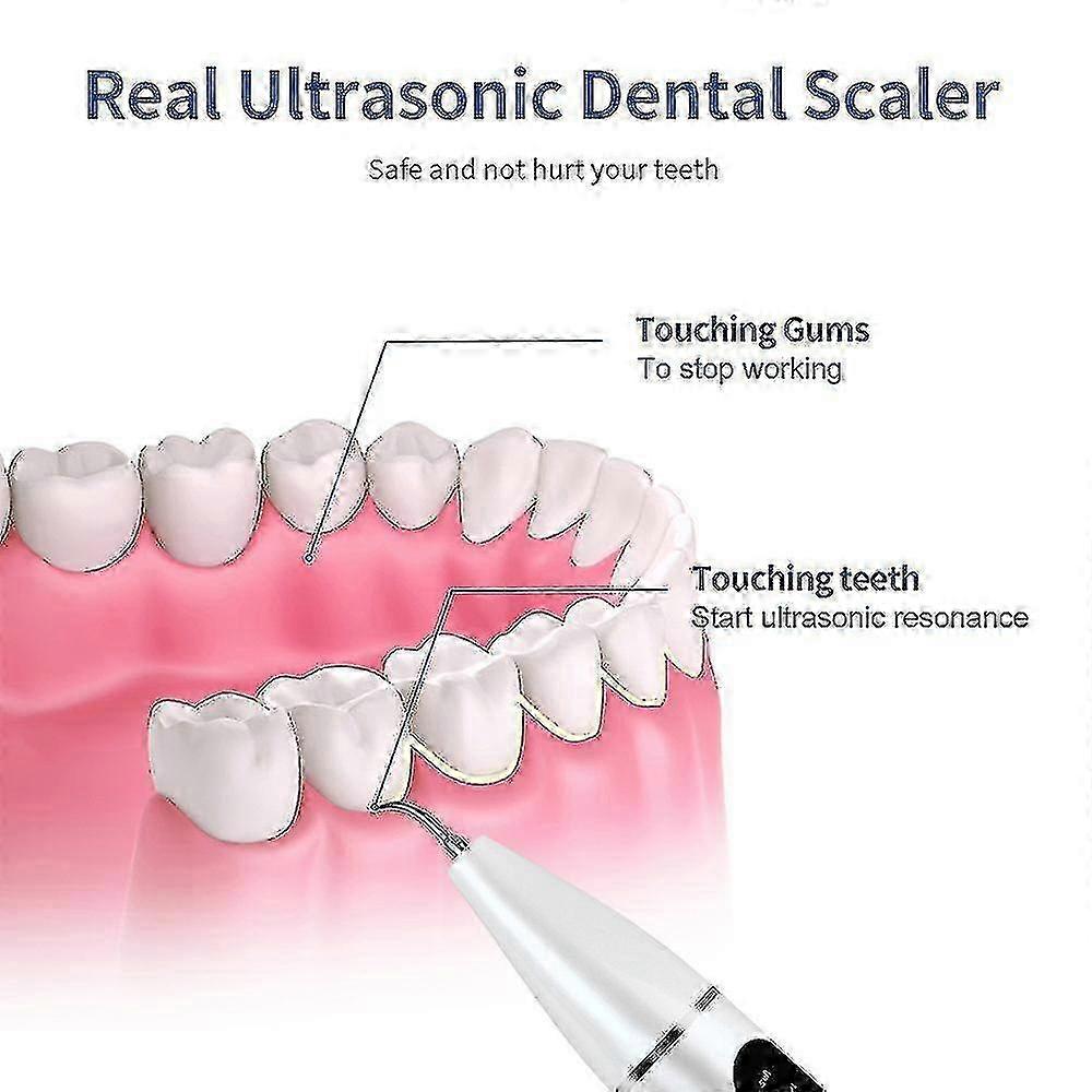 Electric Ultrasonic Dental Scaler Cleaning Kit Tartar Plaque Calculus ...
