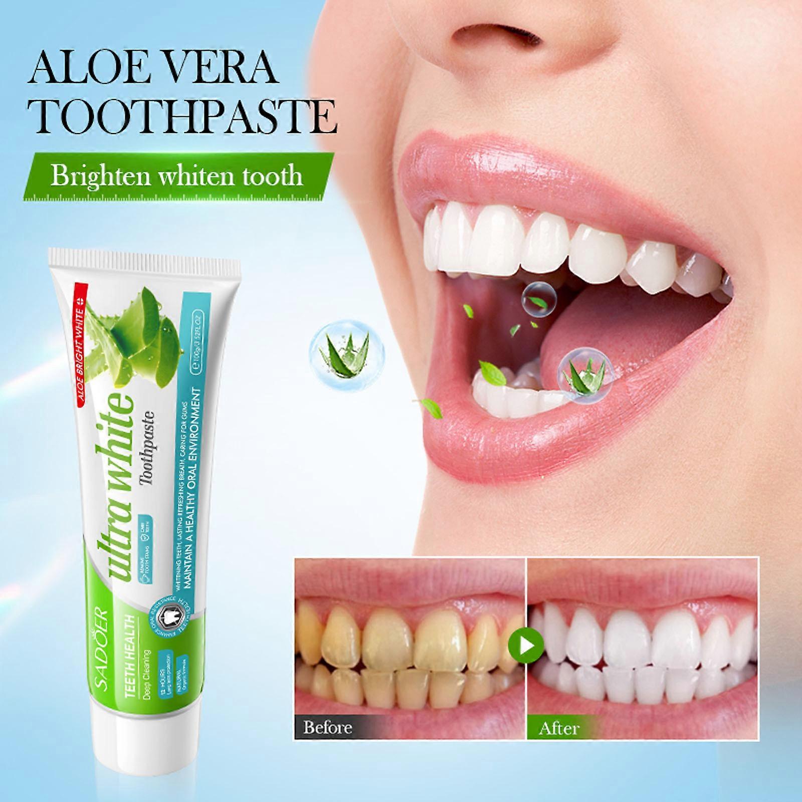 Aloe Whitening And Stain Removing Toothpaste Oral White Teeth And Gums ...