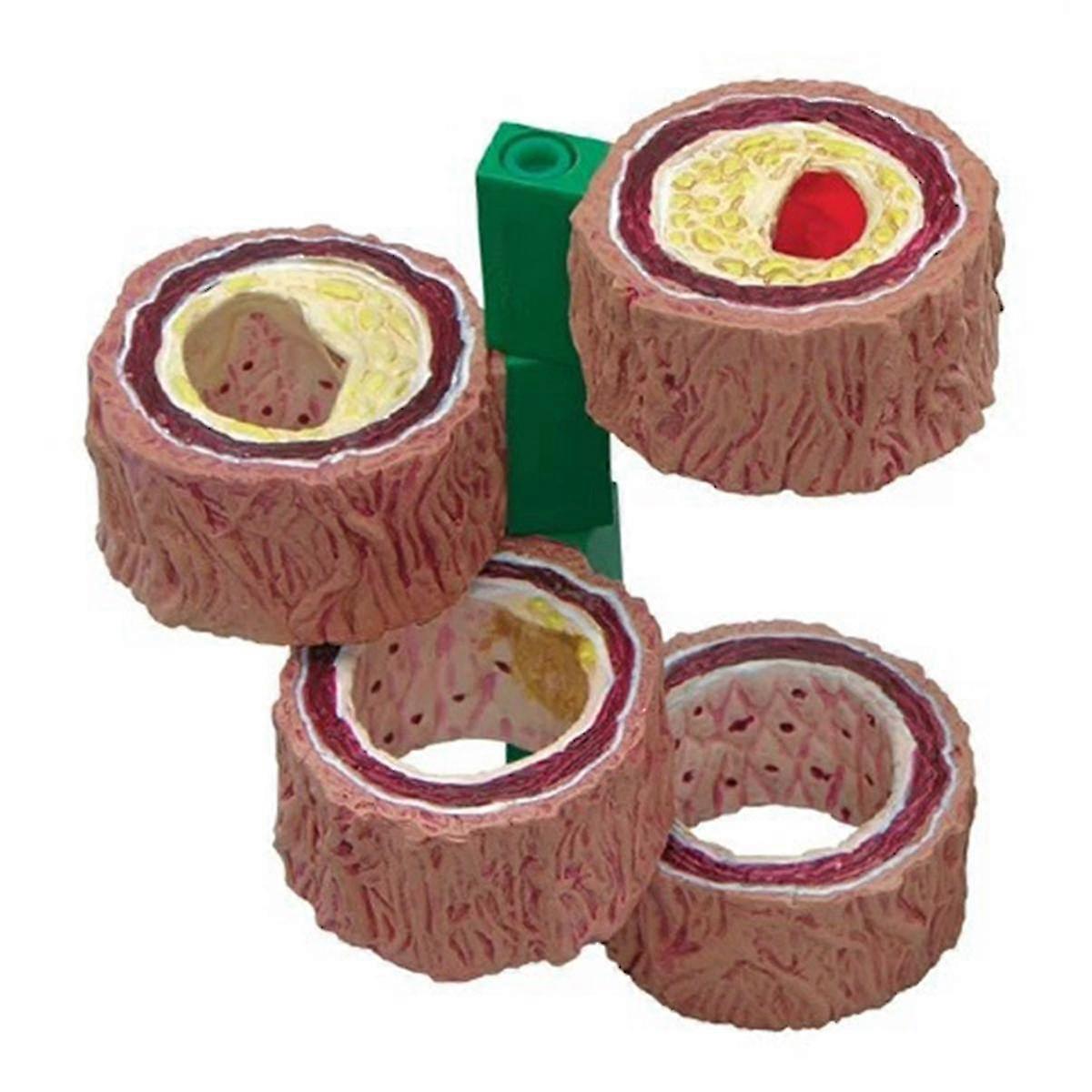 Human Body 4-Piece Artery Model, Anatomical Replica Model, Sclerosis ...