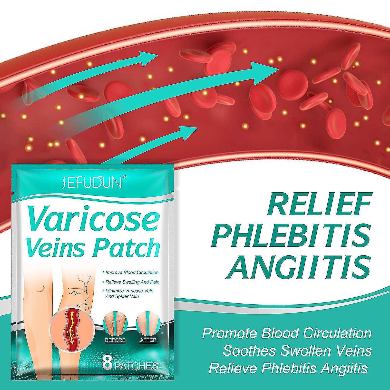 Varicose Veins Patch Relief Leg Vasculitis Spider Varicose Vein Patches ...
