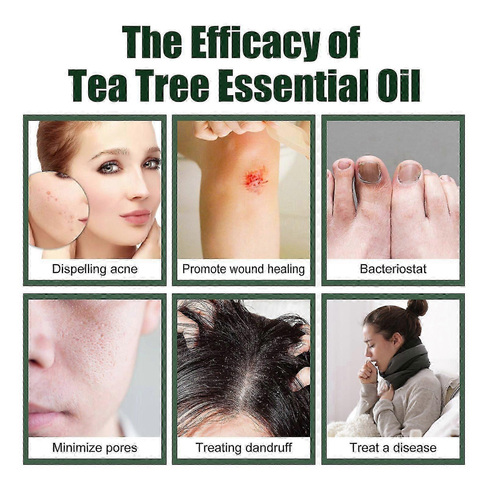 Tea Tree Oil, Organic Tea Tree Essential Oil, 30ml Pure Tea Tree Oil for Skin Moisturizes and ...