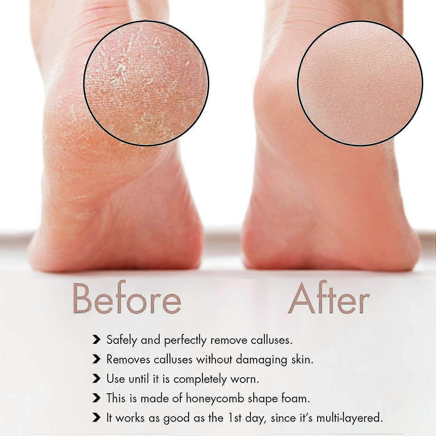 For Dry Feet, Cracked Heels, And Foot Exfoliator | Pedicure Tools For ...