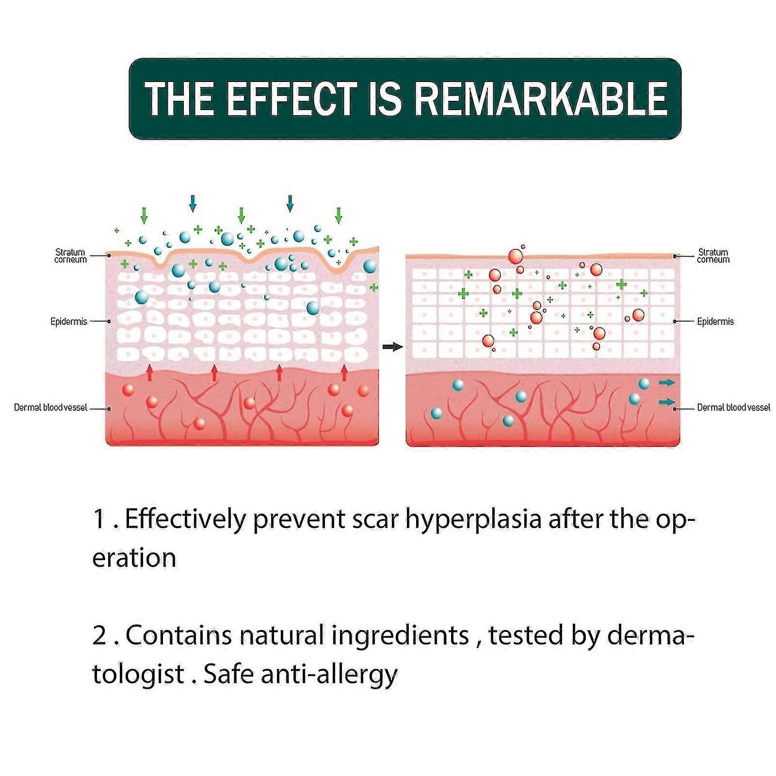 Silicone Scar Sheets - Extra Long Scar Sheets for C-Section, Tummy Tuck ...