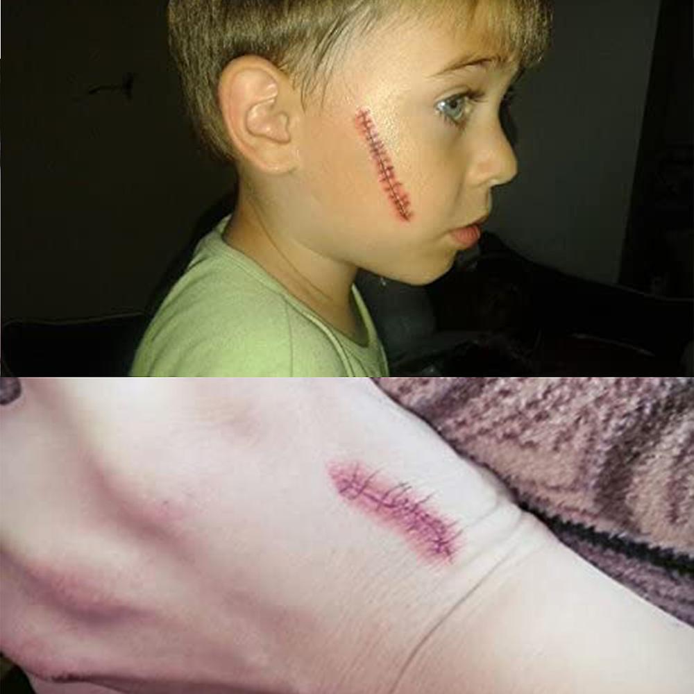 Scar tattoo stickers Fake Wounds Temporary Tattoo Scar Stickers for ...