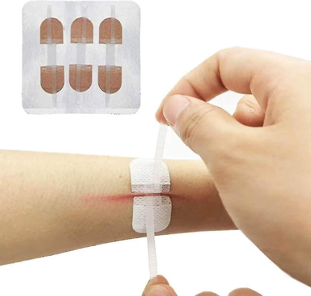 Emergency Wound Closures Band-aid Adhesive Bandages, Zip Stitch ...