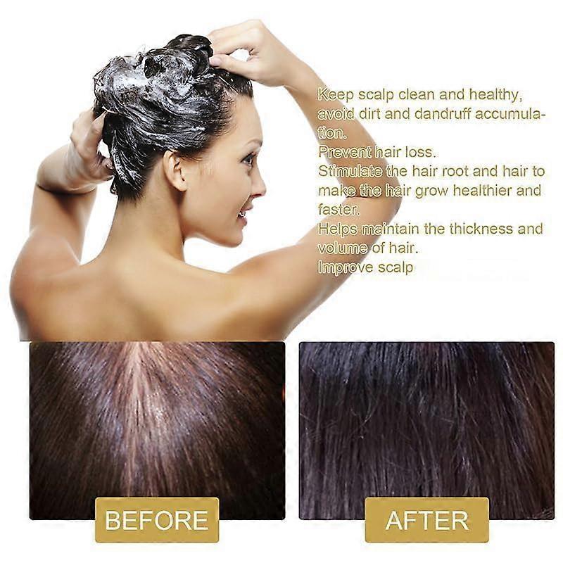 Bai Hei Ke Shampoo, Bai Hei Ke Anti-Hair Loss Shampoo, White Hacker ...