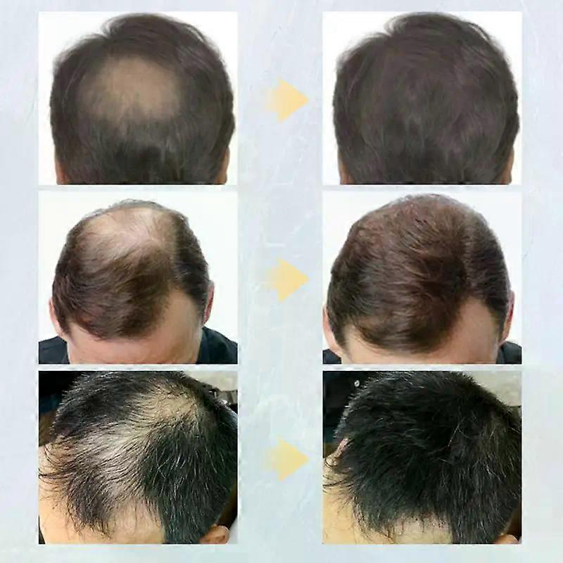 Toppik Hair Loss Building Fibers Hair Fibers Regrowth Powders Keratin ...