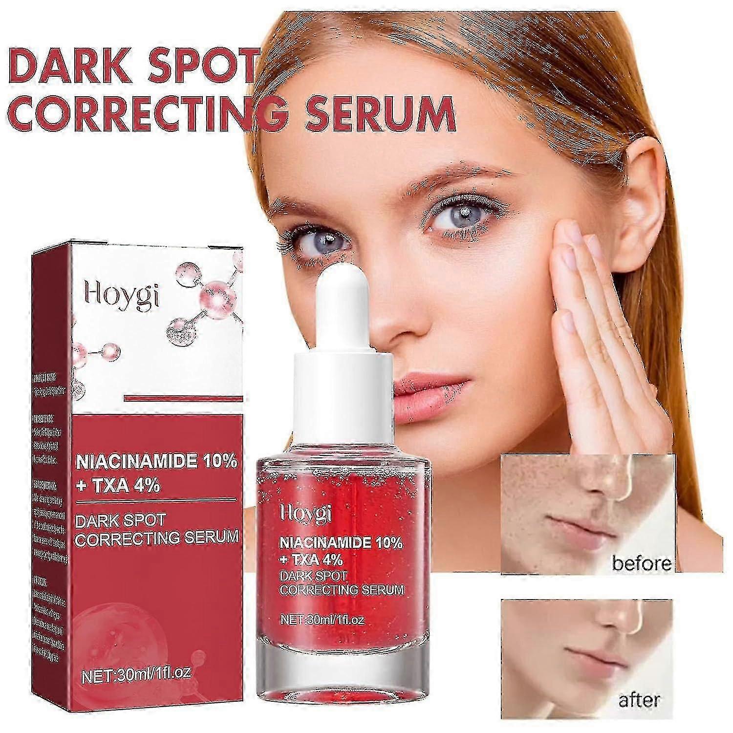Dark Spot Correcting Serum, 10% Niacinamide+ 4% Tranexamic Acid, Anti-aging Dark Spot Correcting ...