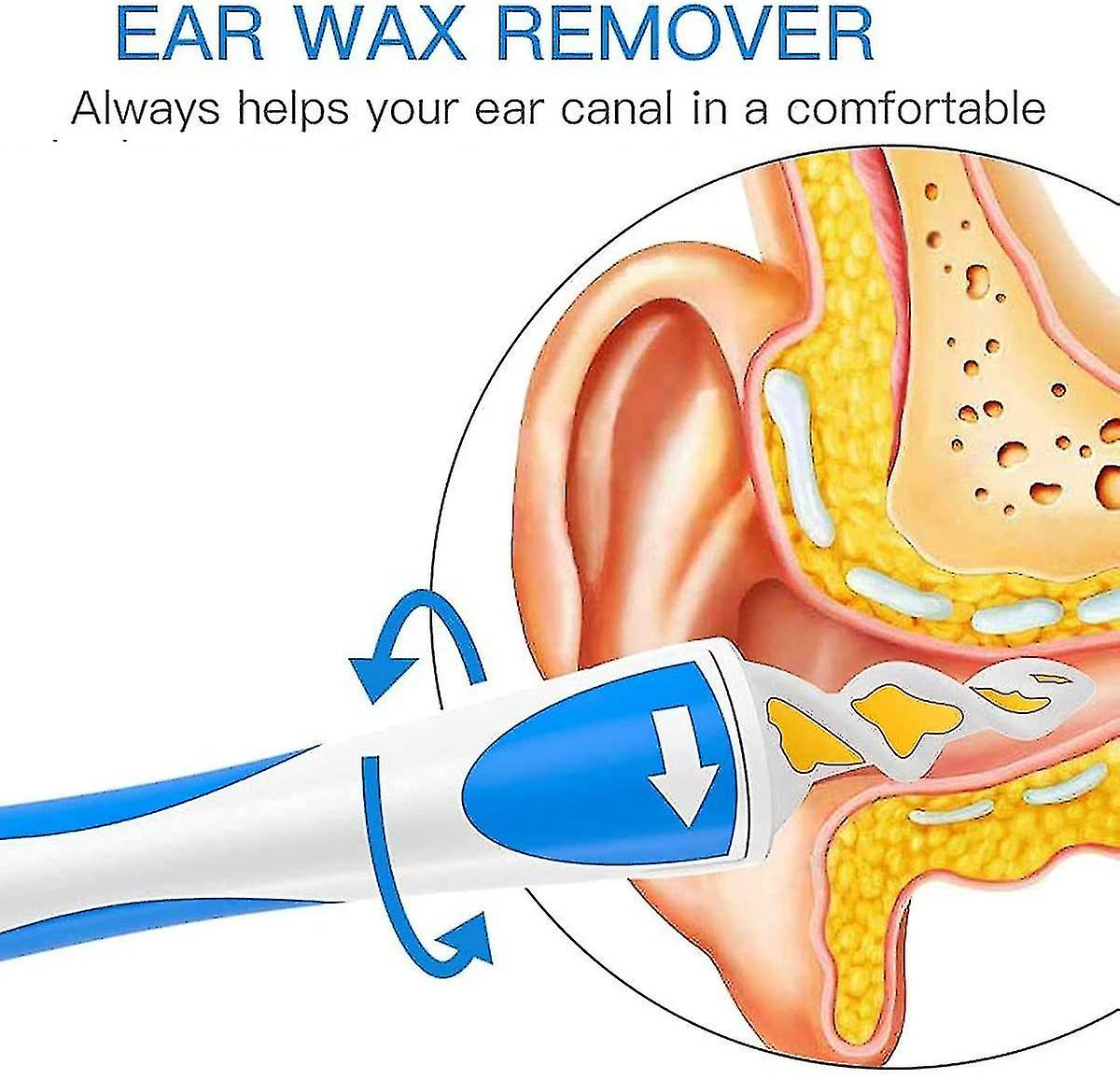 Q Grips Ear Wax Removal Tool - Reusable Safe Ear Wax Remover Kit With ...