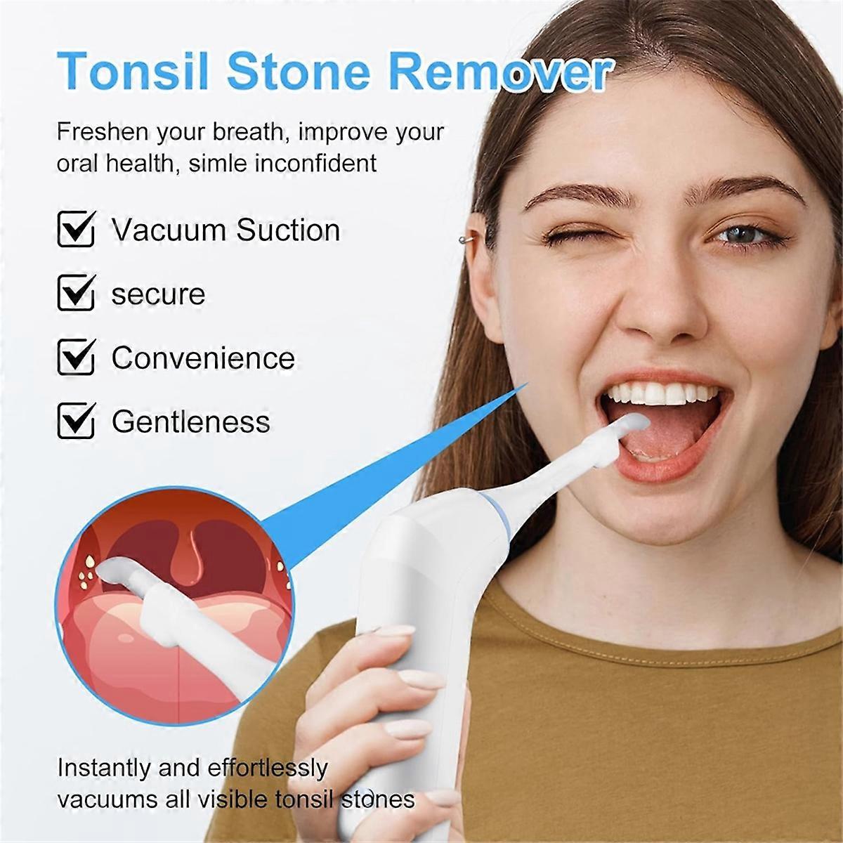 Electronic Tonsil Stone Remover with Camera, Tonsil Stone Removal Kit ...