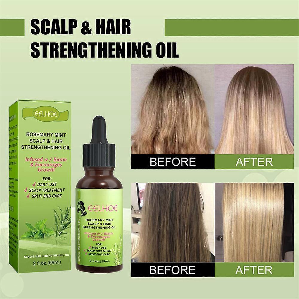 1-3pcs Romarin Menthe Hair Nutrition Liquid Hair Growth Scalp ...
