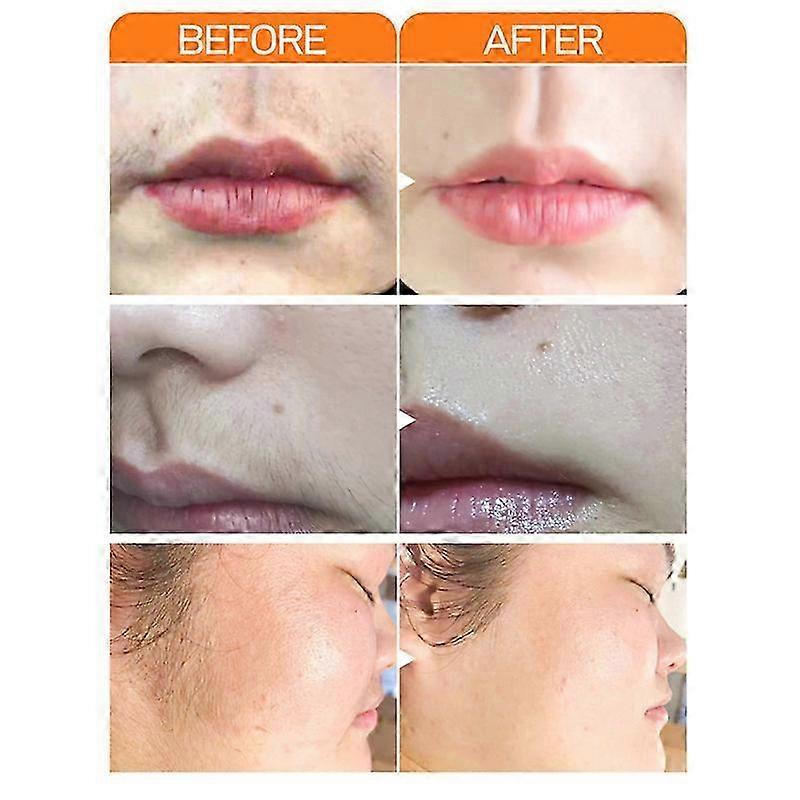 3Pcs Hair Removal Creams Fast Gentle Removal Skin Care Whitening Clear ...