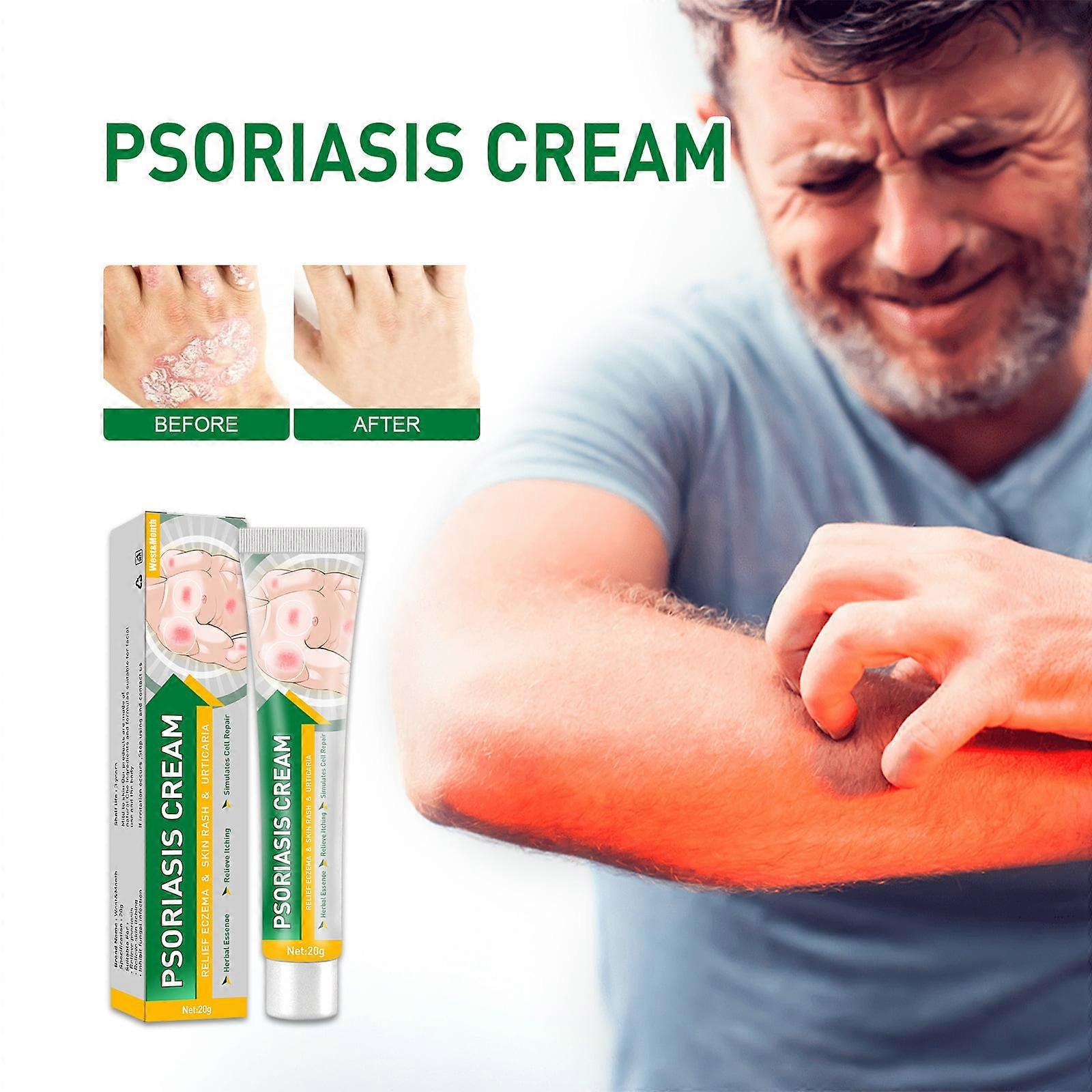 Anti-Itch Cream with Temporarily Relief from Rashes with Eczema-Prone ...