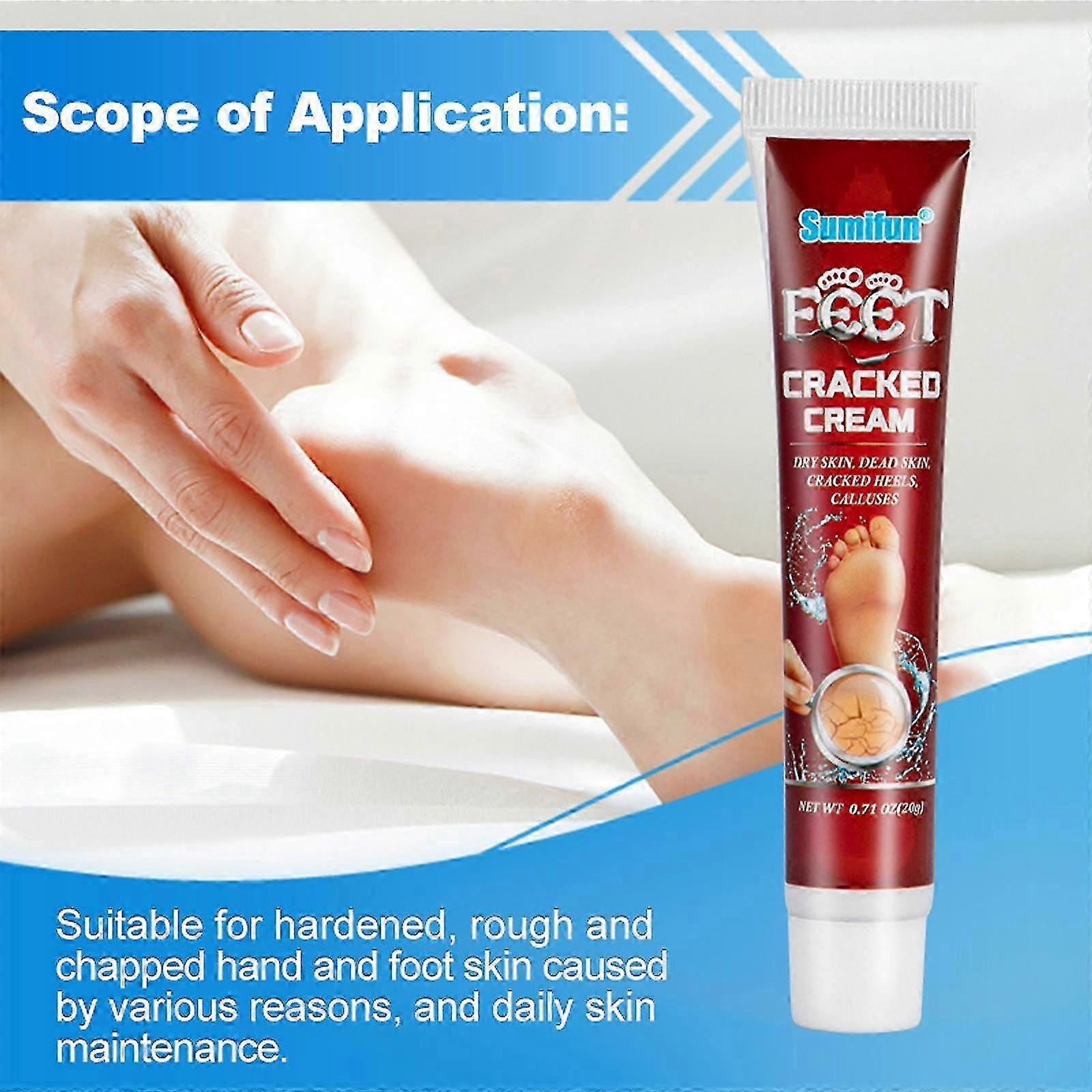 Cracked Hands And Feet Cream Dry Crack Anti-freeze Crack Crack Crack ...