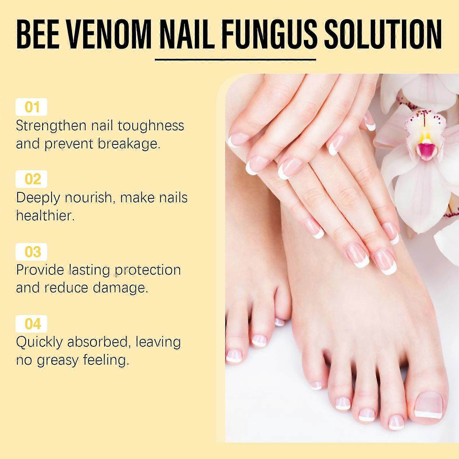 Bee Venom Toenail Fungus Treatment, Varpaankynsien sienihoito Extra ...