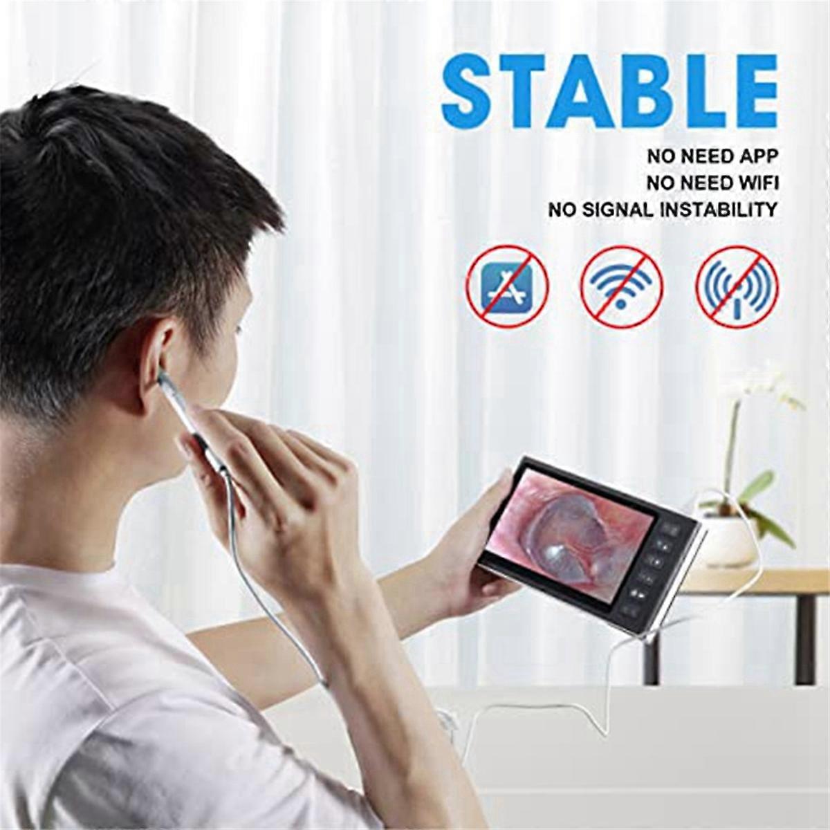Digital Otoscope with 7-Inch Screen, Ear Camera, Visual Ear Scoop ...