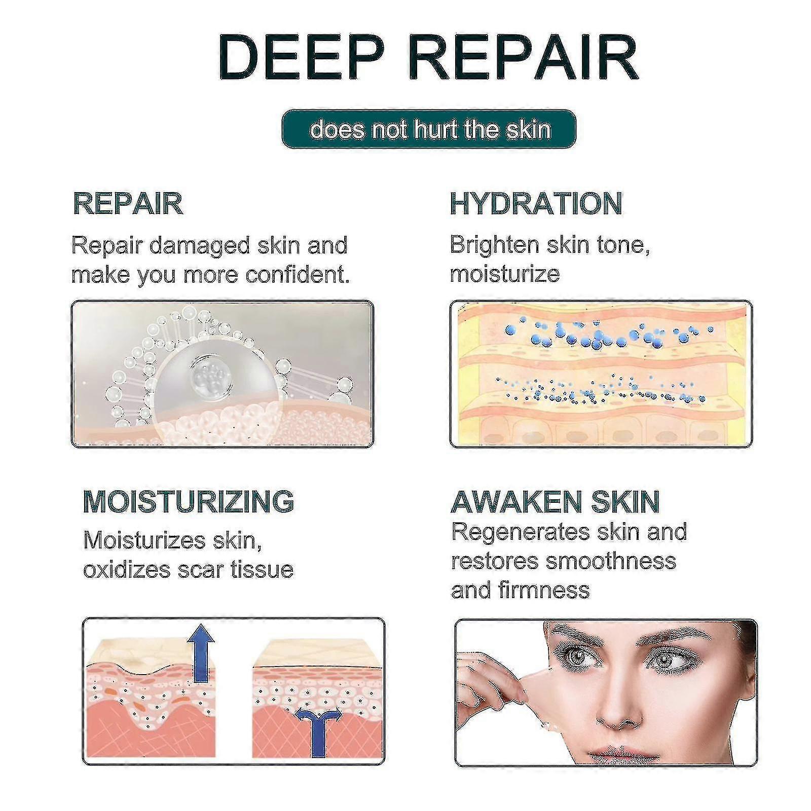 Elaimei Scar Roll Sticker Self-adhesive Silicone Gel Scar Sticker 3m ...