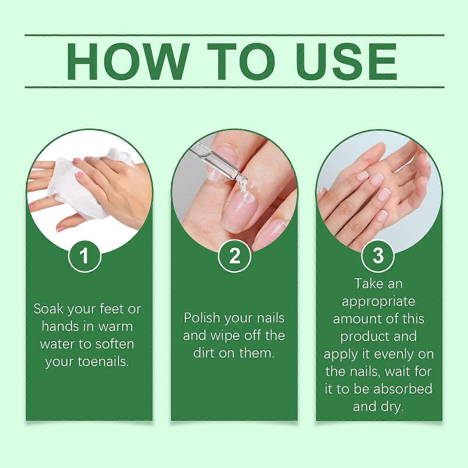 Bee Venom Nail Care Oil, Gentle Repair Soft Nails, Thick Nails, Inlaid ...