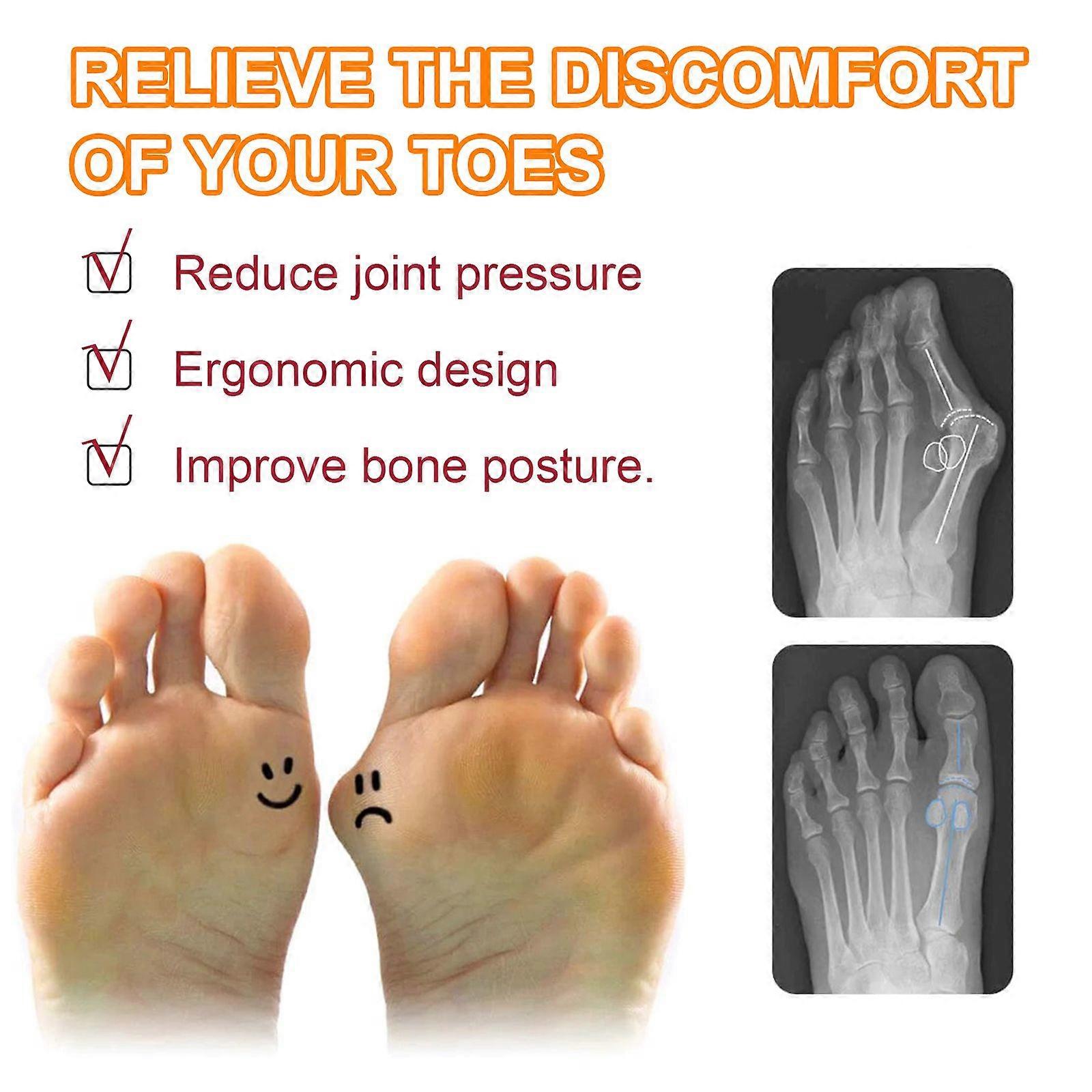 Health Socks, Relieve Soreness And Discomfort Correct Foot Thumb Valgus ...