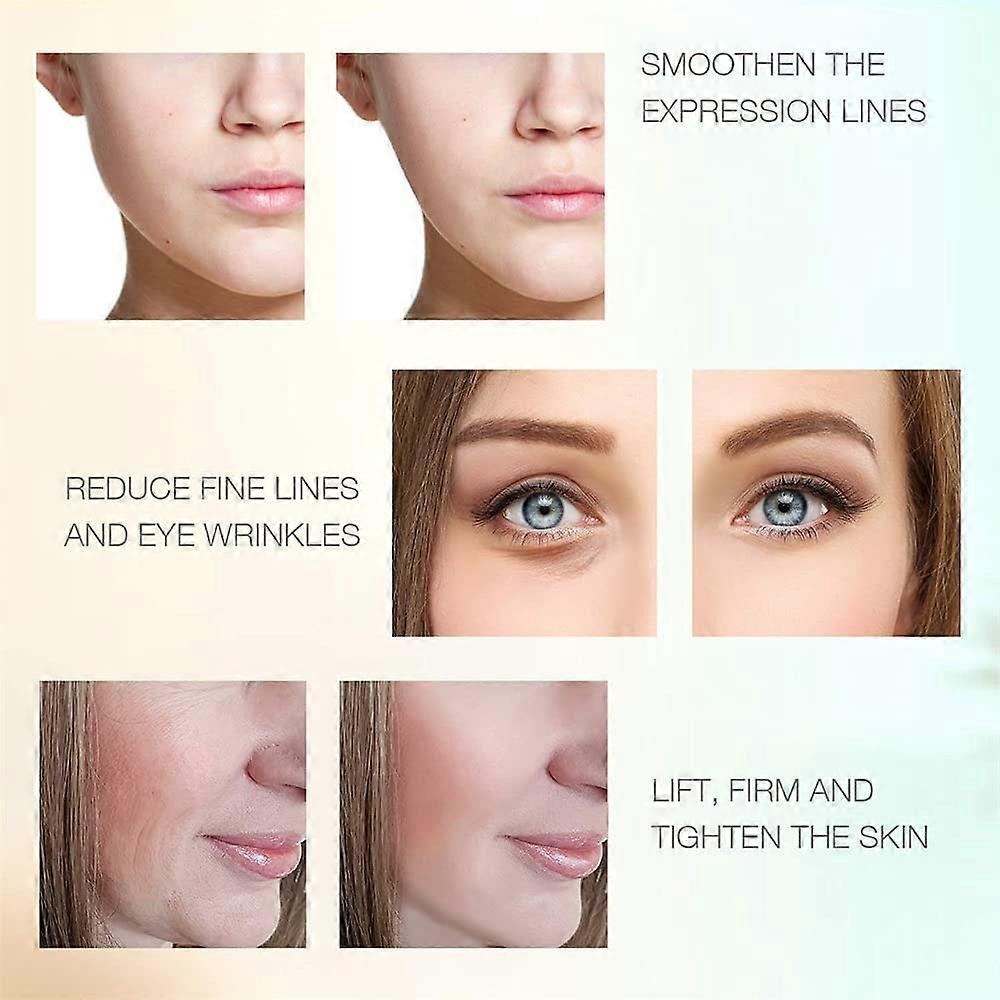 RF Radio Frequency Facial And Body Skin Tightening Machine ...