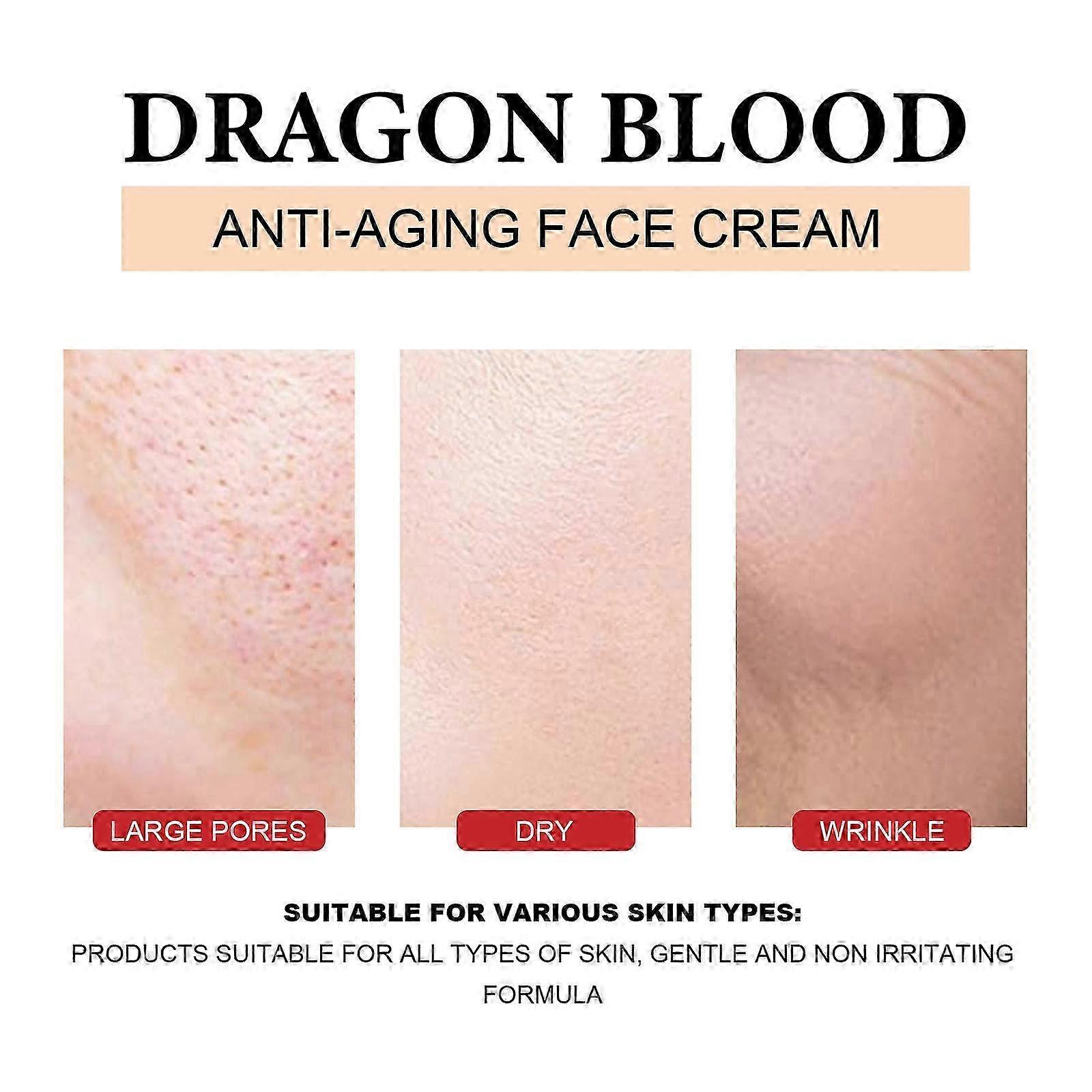 Dragons Blood Easy Cream, Retinol Placenta Dragon Blood Cream, Dragon ...
