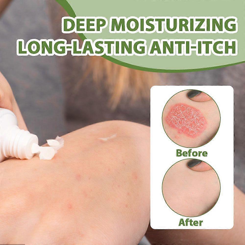 Sumifun Tea Tree Oil Eczema Anti-itch Ointment Efficacy On Skin Anti ...