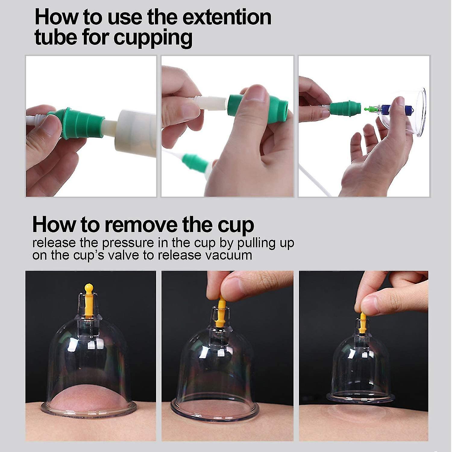 Cupping Therapy Sets,24 Cups Cupping Set With Pump Vacuum Suction Cups ...