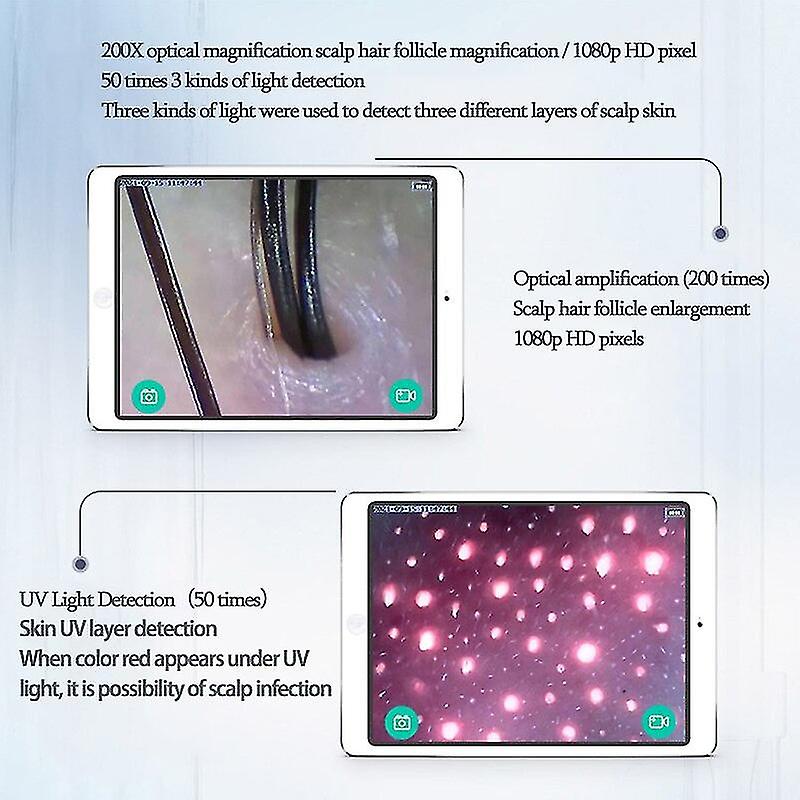 Wifi Hd 5g Scalp/skin /hair Follicle Detector Professional 50x/200x ...