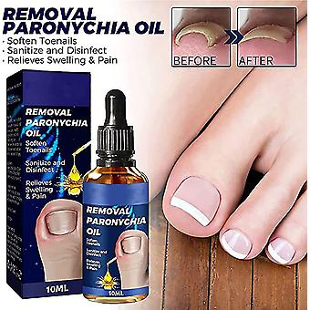 Toenailcare Removal Paronychia Oil, Ingrowing Toenail Treatment Oil ...