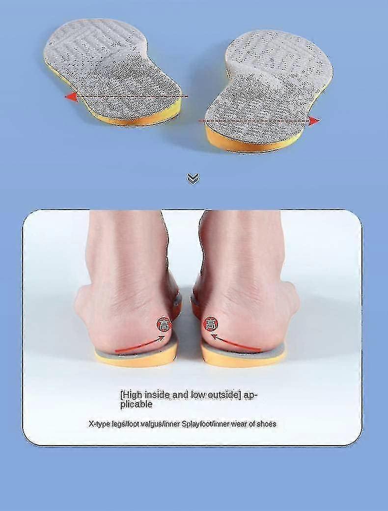 Supination Insoles for Over Supination & Foot Alignment Orthotic ...
