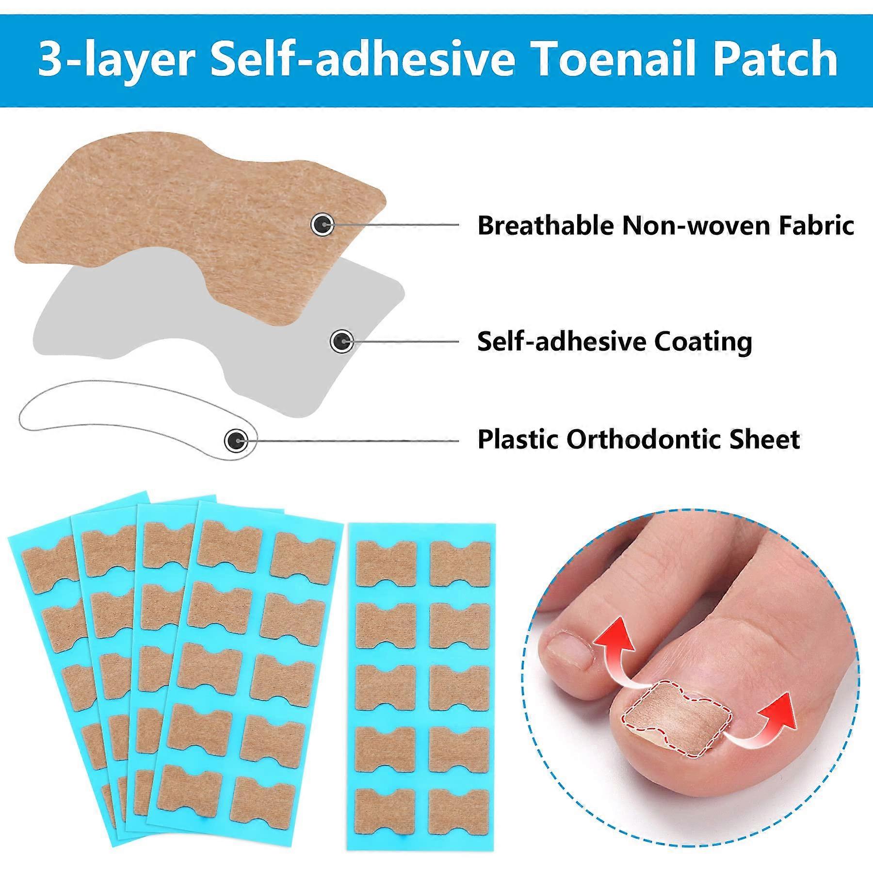 100 Pieces Ingrown Toenail Tool Set with 2 Corner Lifters, Foot Care ...