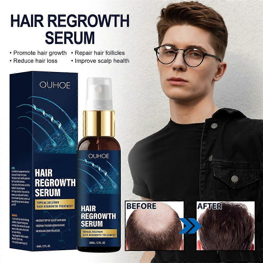 Hair Growth Serum Liquid Fast Growing Repair Hair Roots Prevent Hair ...