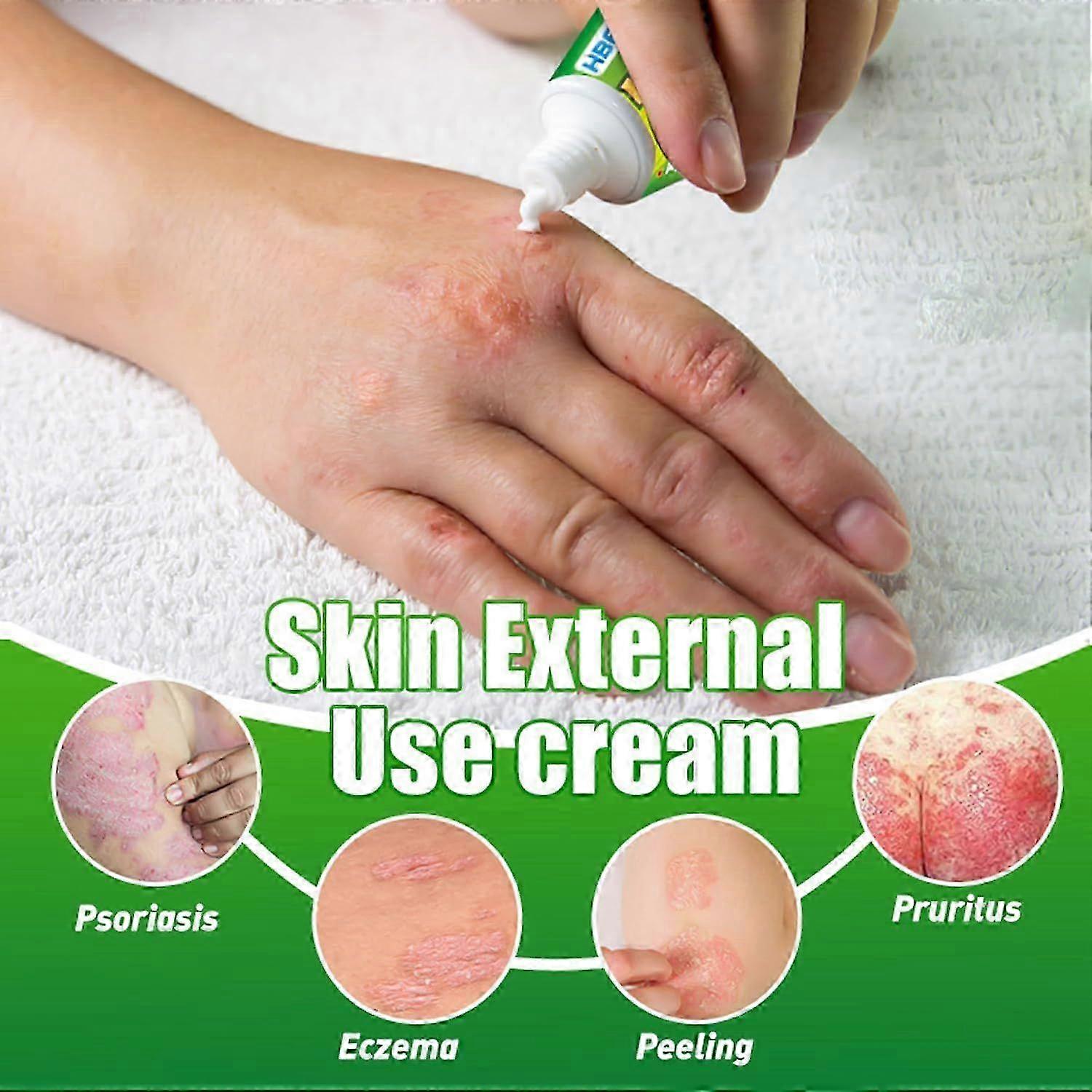Antifungal Cream 20g - Anti Fungal Skin Cream Relief Jock Itch ...