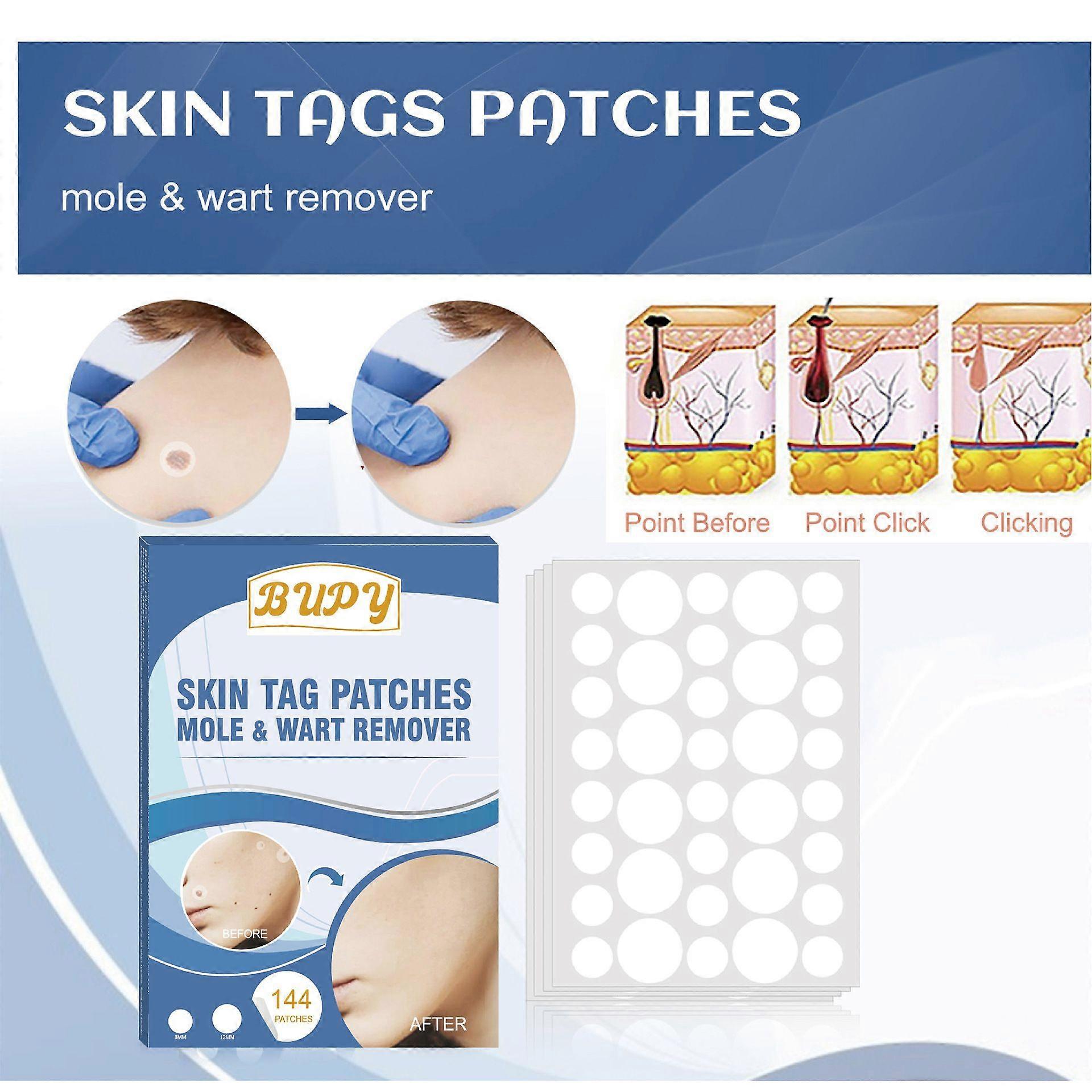 Wart Removal Patches,Wart Removal Plasters Pads,Mole Remover Treatment ...